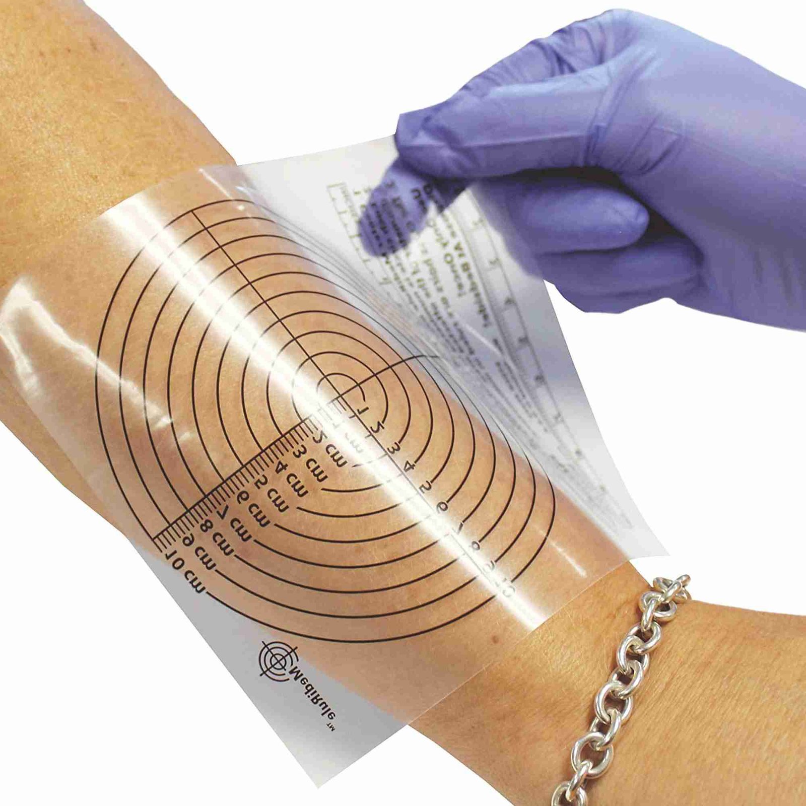 Briggs® MediRule™ Wound Measuring Device - Jeritek LLC